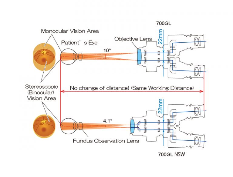 Slit Lamp Evolution, 700GL NSW with Integrated Stereo Angle Variator ...